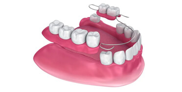 Full and Partial Dentures Austin, TX | TRU Dentistry